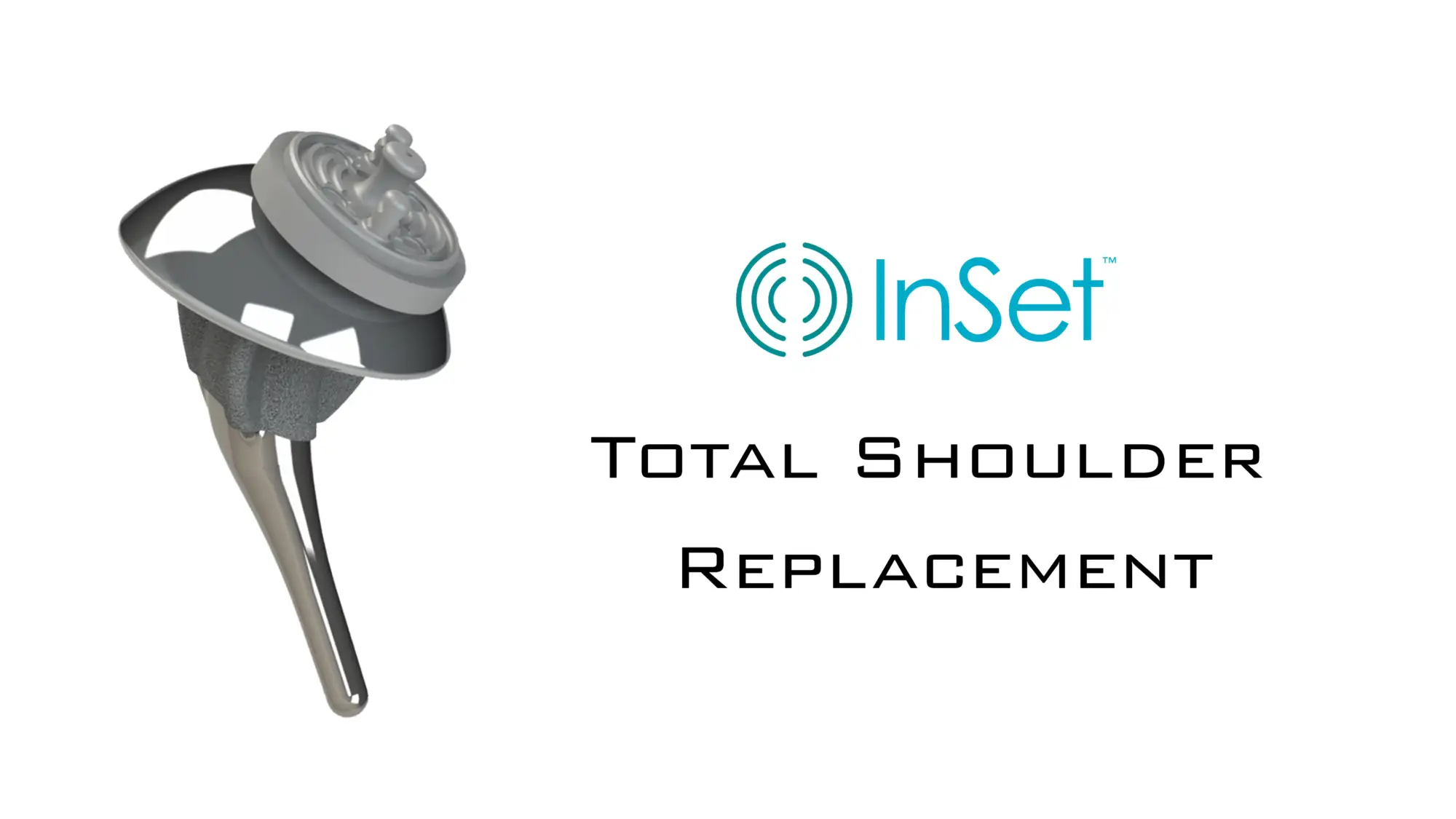 What Is a Reverse Total Shoulder Arthroplasty? - James Andry, MD